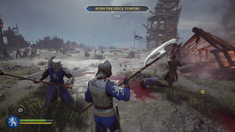 Chivalry 2 tips: How to defend yourself and win fights